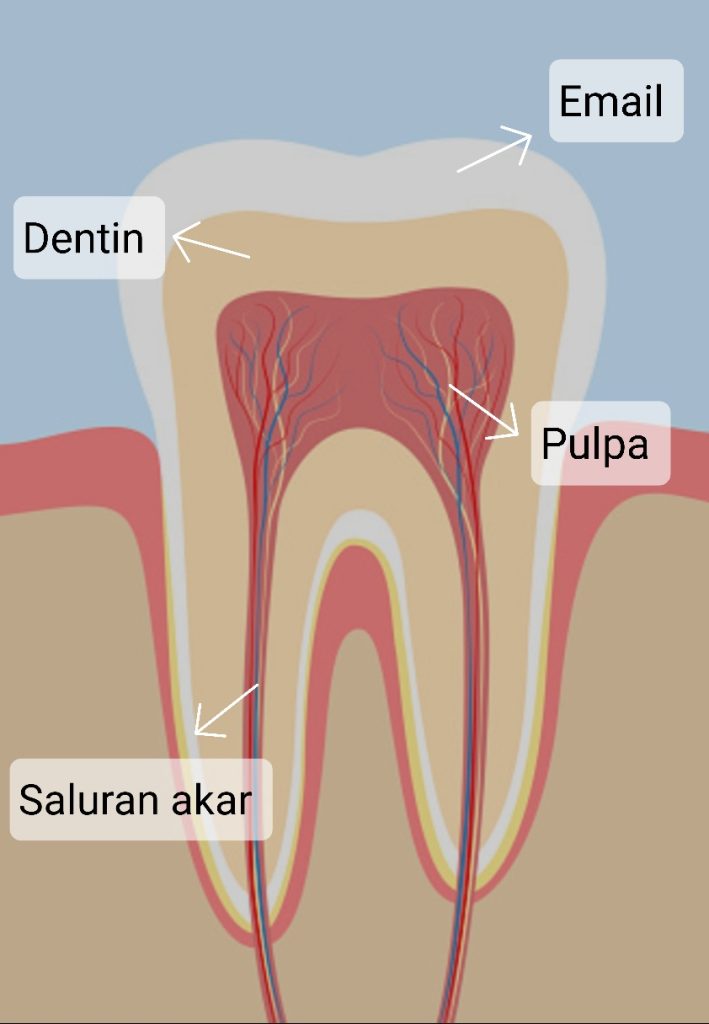 Perawatan Saluran Akar - Andini Dental Jogja
